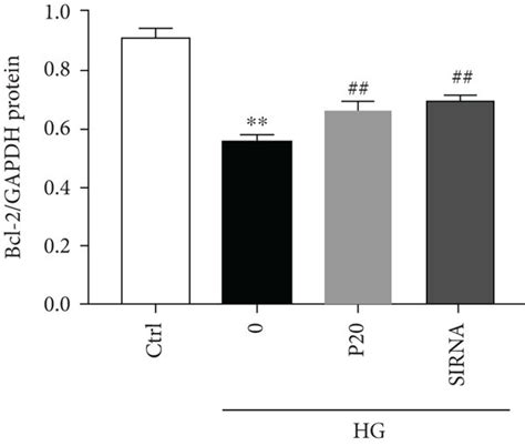 The Hif 1α Silence Mimicked The Effect Of Propofol In H9c2 Cells During
