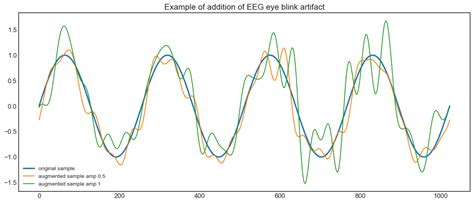 Data Augmentations Guide — Selfeeg 0 2 1 Documentation