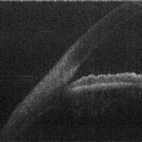 Tm Object Detection Dataset By Ivan Lee