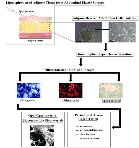 Schematic Representation Of The Isolation Of Human Adipose Derived Download Scientific Diagram