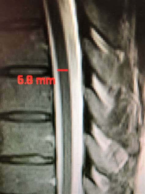 Mri Of The Spinal Cord T2 Weighted On Sagittal Plane At D6 Level The