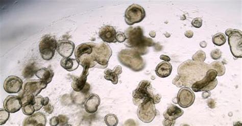 Stem Cell Based Gut On A Chip A New Path To Personalized Medicine The Stem Cellar