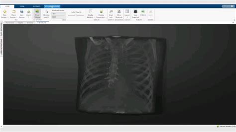 Dr Mahdi Pourabdollah On Linkedin Medicalresearch Imageanalysis