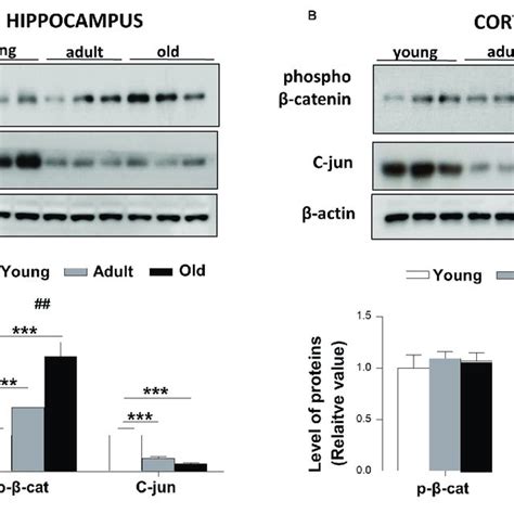 Phospho β Catenin Levels Are Increased And C Jun Target Gene Protein