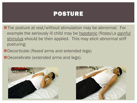 Pediatric Assessment Triangle Ppt
