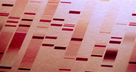 Risk Adapted Therapy And Mrd Guided Strategies Healthtree For Multiple Myeloma