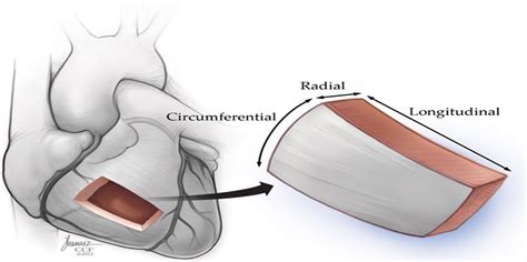 Perioperative Assessment Of Myocardial Deformation Anesthesia And Analgesia