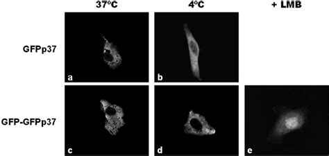 Effect Of Temperature Shift And Treatment With Lmb On The Subcellular