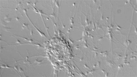 Das Prinzip Der Polarisationsmikroskopie Lernen And Teilen Leica