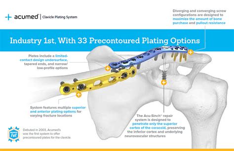 Shoulder Acumed Information