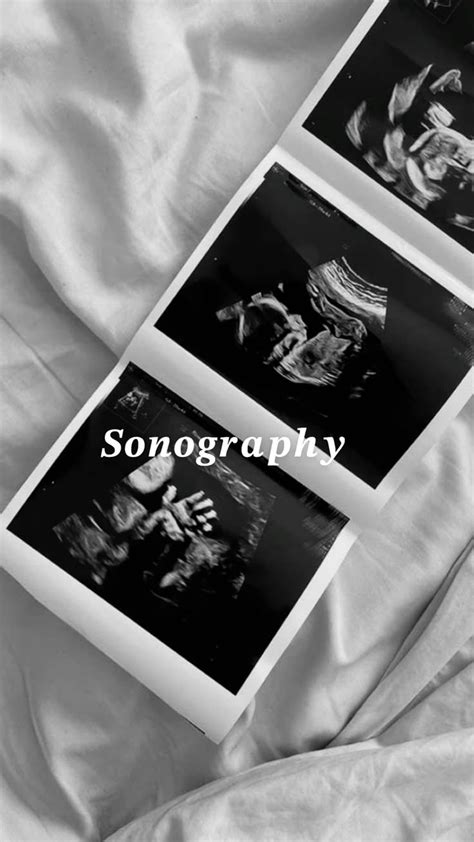 Sonography Ultrasound Technician Diagnostic Medical Sonography