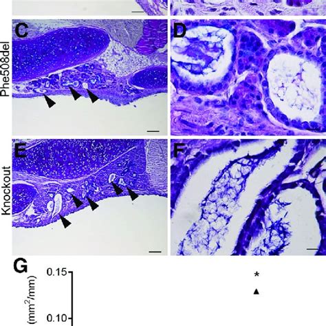 Trachea Histology And Submucosal Gland Area Quantification In Phe508del