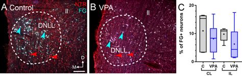 VPA Exposure Did Not Impact Projections From The DNLL To The MG A
