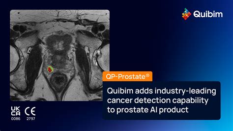 Quibim Adds Industry Leading Cancer Detection Capability To Prostate Ai Product Quibim Website
