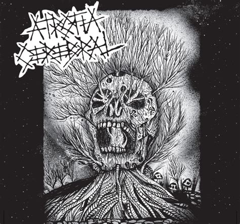 Atrofia Cerebral Exacerbación Atrofia Cerebral Exacerbación 2020