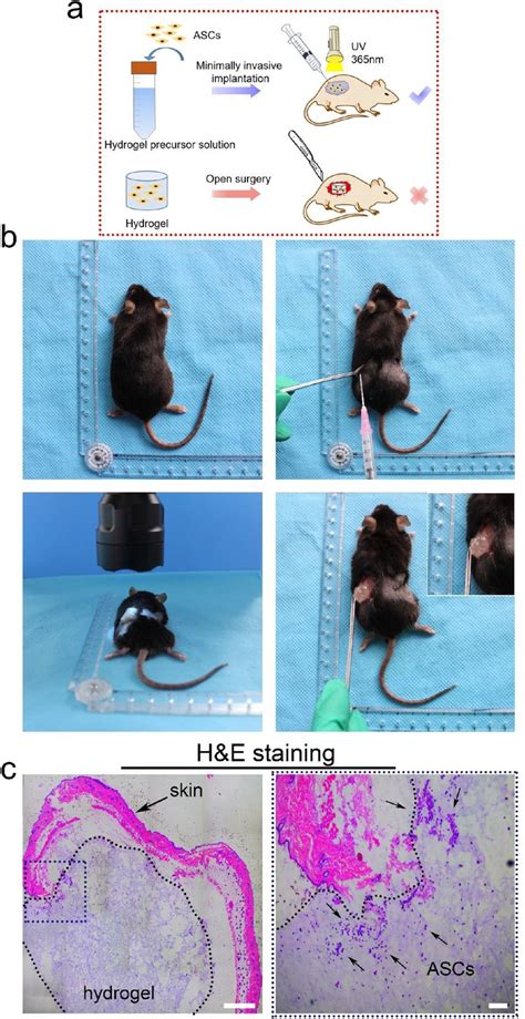 A Schematic Diagram Of Minimally Invasive Implantation And Open Download Scientific Diagram