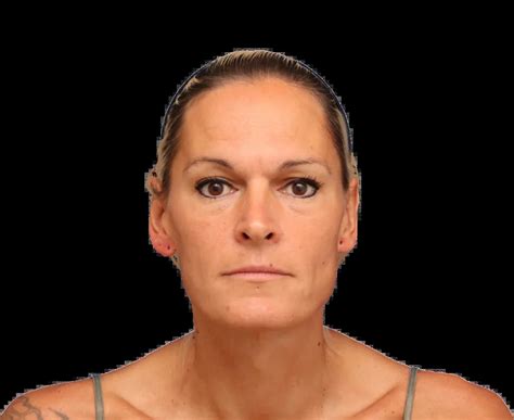 Julia Before And After Ffs Surgery — Facialteam