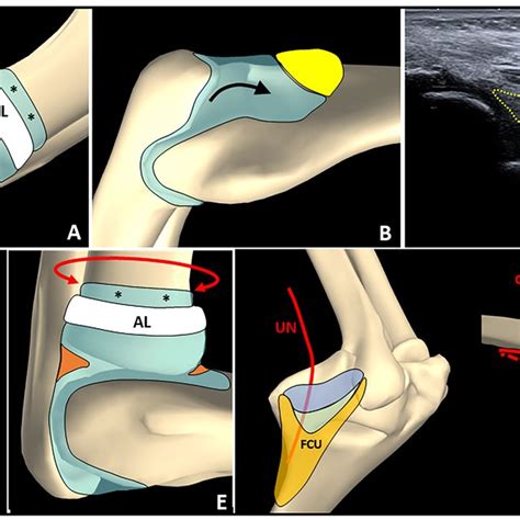 Imagens Of A Normal Mcp Joint And An Abnormal Mcp Joint Of A Ra Download Scientific Diagram