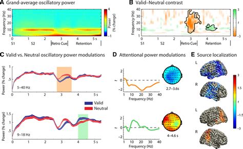 Timefrequency Representations Of Valid And Neutral Retrocue Trials Download Scientific Diagram