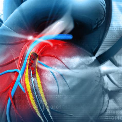 Ganeshaa Heart Care
