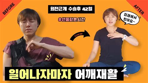 어깨재활 수술후 1개월 그리고 3개월후회전근개파열 수술후 42일차 Youtube