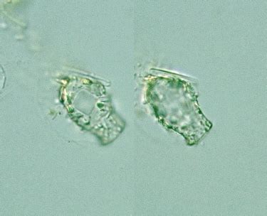 Protist Images Difflugia Globulosa Protist Images Difflugia Globulosa