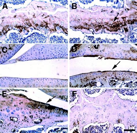 Immunohistochemical Detection Of Collagen Type X Expression In 6 Mo Old