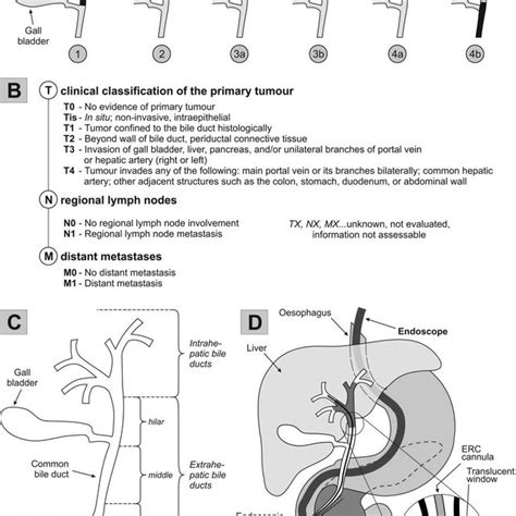 Anatomy Bismuth Tnm Classification And Pdt For Hilar Download