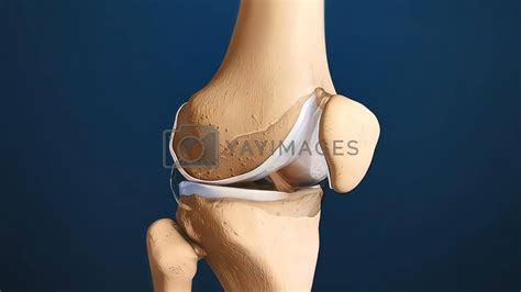 Cross Section Through A Typical Synovial Joint Showing The Bone