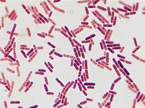 E Coli Micrograph