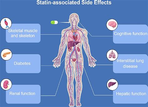 San Fatih On Linkedin Statinintolerance Management Of Statin