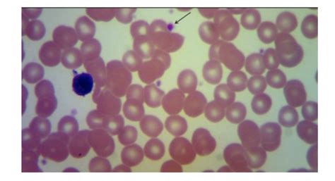 Basophil Diagram Quizlet