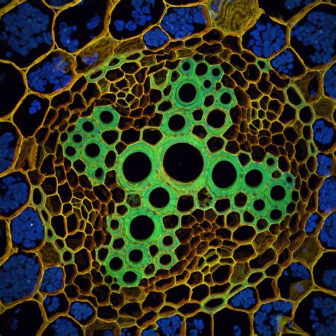 Ranunculus Buttercup Root Xylem And Phloem Nikon Small World