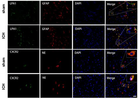 Expression Of Lpa1 And Cxcr2 In Cells At 24 H Following Ich