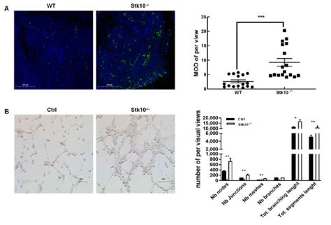 Stk10 Deficiency Led To Abundant Tumor Angiogenesis A Cd31 Download Scientific Diagram
