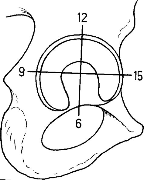 Diagram Showing The Clockwise Location Of The Labral Lesions Download Scientific Diagram