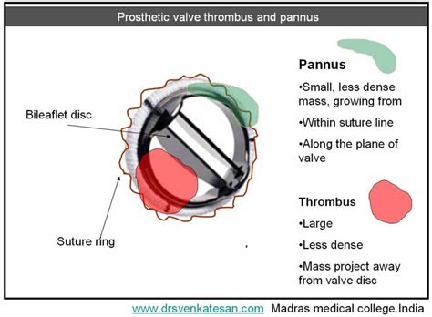 обои на стену в спальню 44 4pannus Treatment Manual Guide Pannus