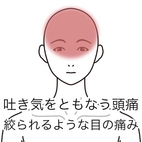 目の奥の痛み、吐き気をともなう頭痛｜吐き気、頭痛のツボ｜ツボネット 鍼灸の症例が検索できるツボ辞典