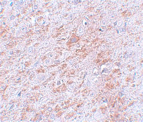 Dclk1 Antibody Bsa Free Nbp1 77127 Novus Biologicals