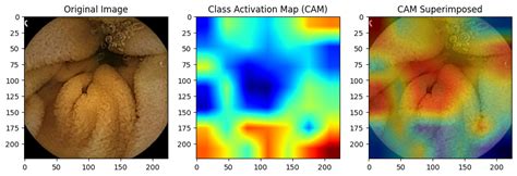 GitHub Akashkalasagond Auto WCEBleedGen Challenge