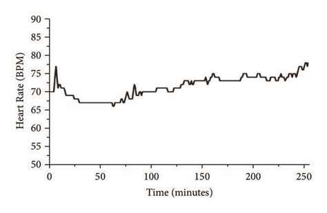 Continuous Recording Of A Cardiac Output B Heart Rate C Stroke Download Scientific