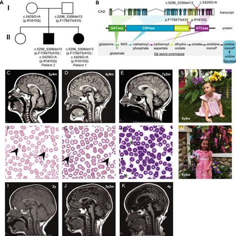 Spatiotemporal Profiles Of Cad Expression In Adult And Developing
