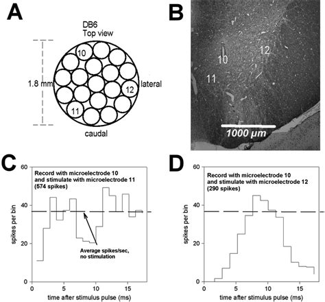 A B The Location Of 3 Microelectrode Tips In The Subthalamic Download Scientific Diagram