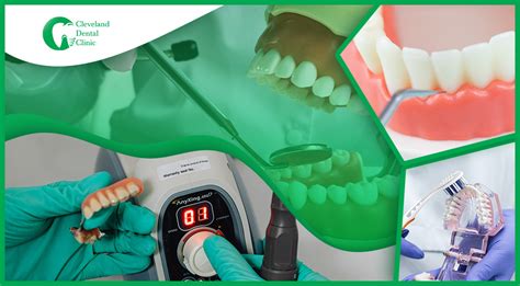 Denture Reline Que Significa At Sandra Slavin Blog