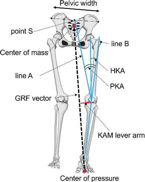 Figure 1 From Higher Association Of Pelvis Knee Ankle Angle Compared