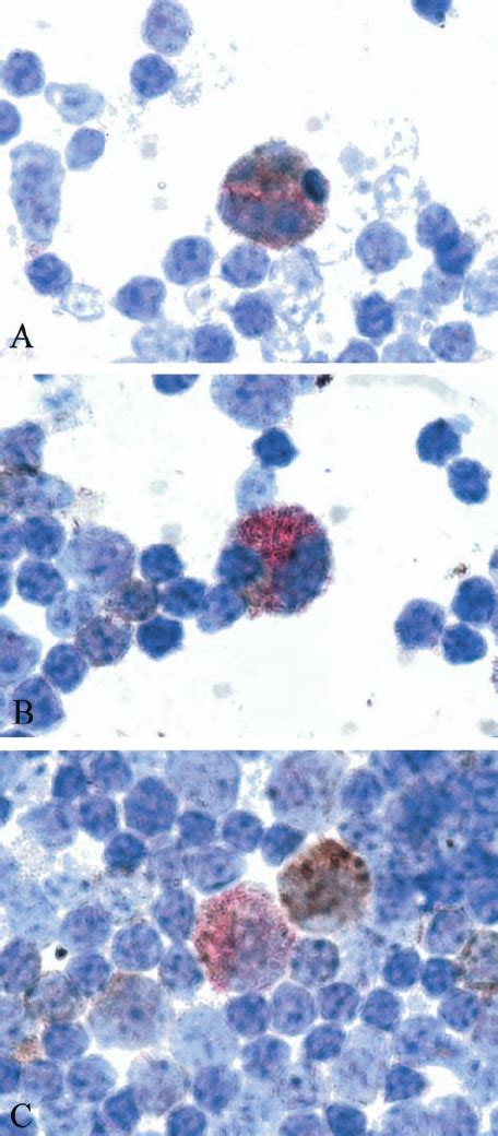 Dual Ihc Co Localization Of Prp Sc Using Prp Specific Mab 999761 Download Scientific Diagram