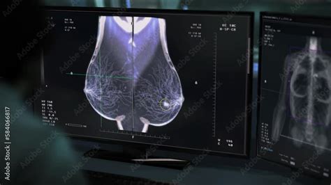 Performing The X Ray Screening Test On The Sick Patients Chest