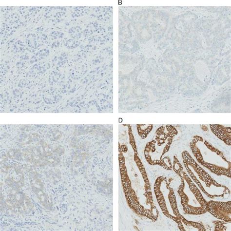Examples Of Different Human Epidermal Growth Factor Receptor 2 Download Scientific Diagram