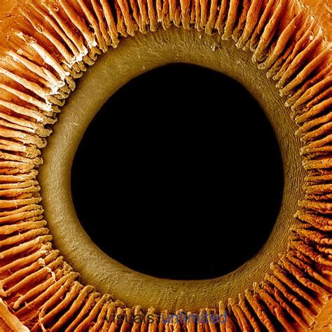 A View Of The Inner Surface Of The Iris Pupil And Ciliary Processes