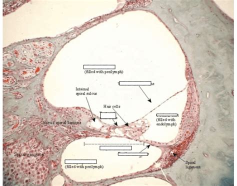 Cochlear Cross Section 2 Quiz